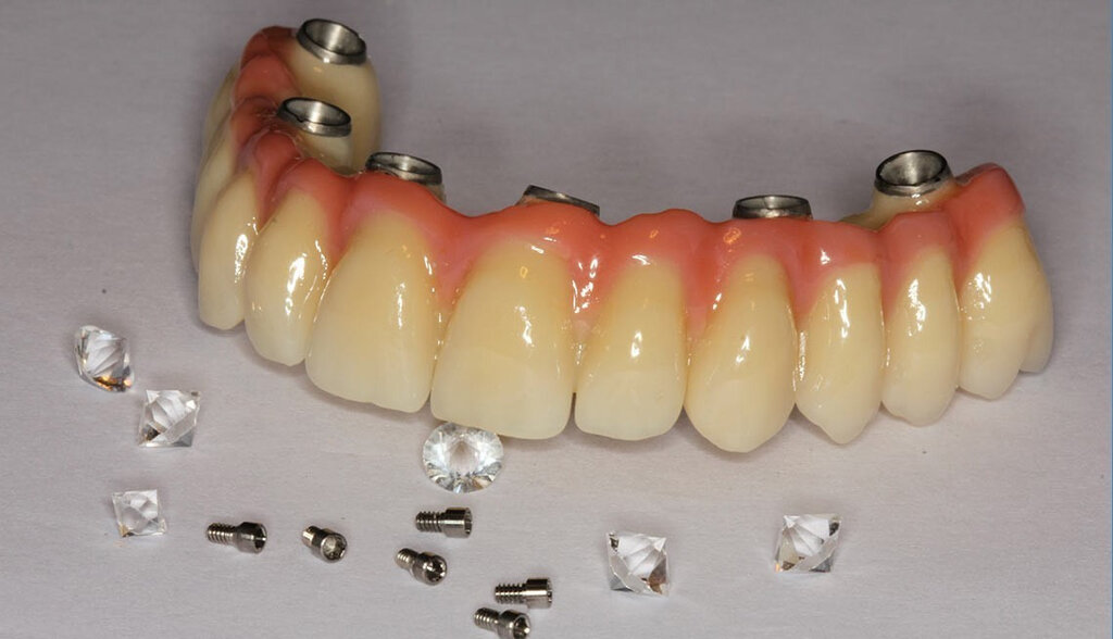 Özel ağız ve diş sağlığı klinikleri ve muayenehaneleri Pro Dentes Zahntechnisches Meisterlabor Ztm Markus Gapp, Tirol, foto