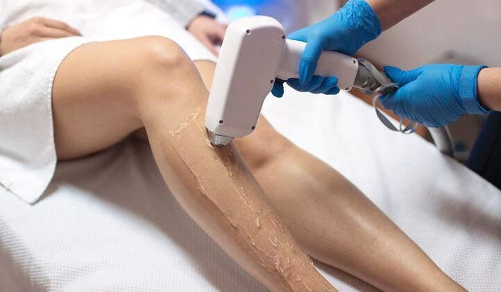 Epilasyon Laser_care, Moskova, foto