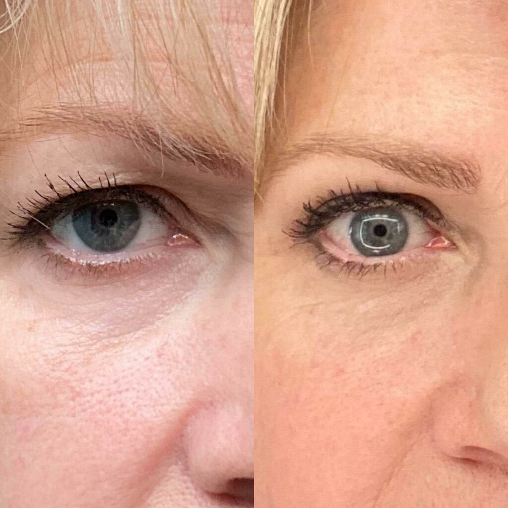 Plastik cerrahi klinikleri Dr. Bryan Costin, Ohio Eyaleti, foto