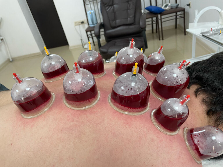 Tıp merkezleri ve klinikler Хиджама центр, Khasavyurt, foto