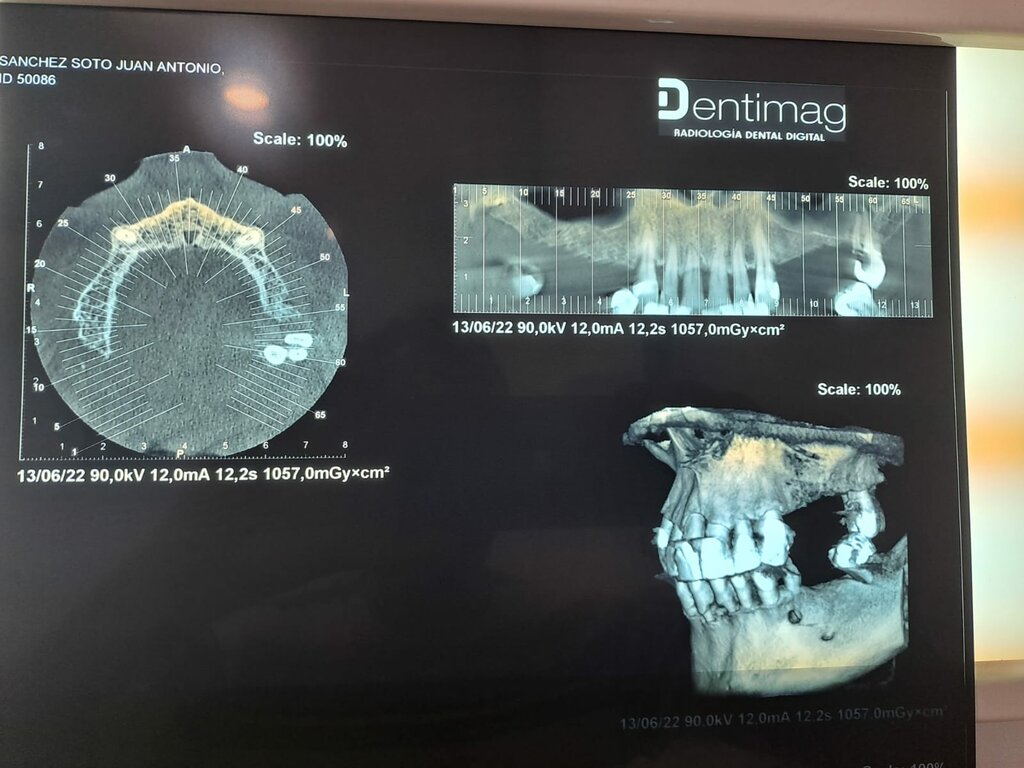 Özel ağız ve diş sağlığı klinikleri ve muayenehaneleri Clínica Dental Fukident Churriana, Endülüs, foto