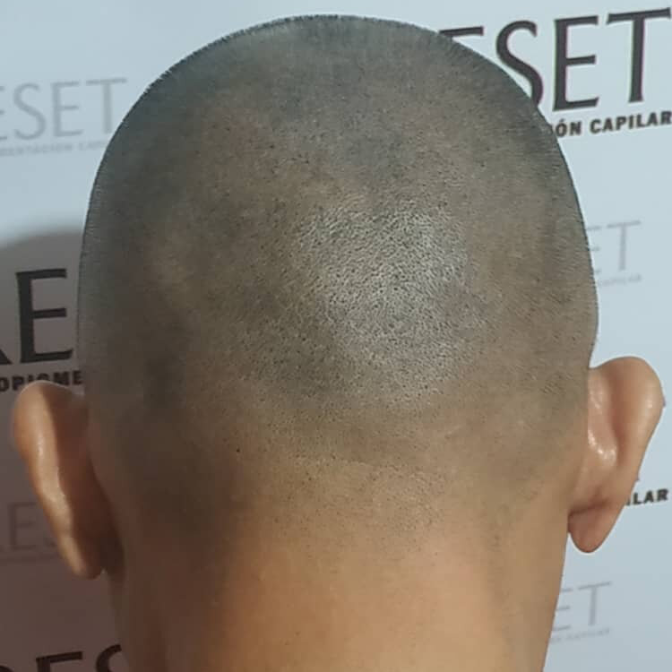 Güzellik salonu Resetmicropigmentacion, Cali, foto