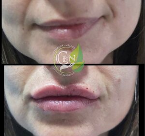 Cbn clínica médico estética (Comunidad Autónoma de Aragón, Zaragoza, Cadrete, Cuarte de Huerva, Calle Bulevar de Cuarte), güzellik salonu  Aragon'dan