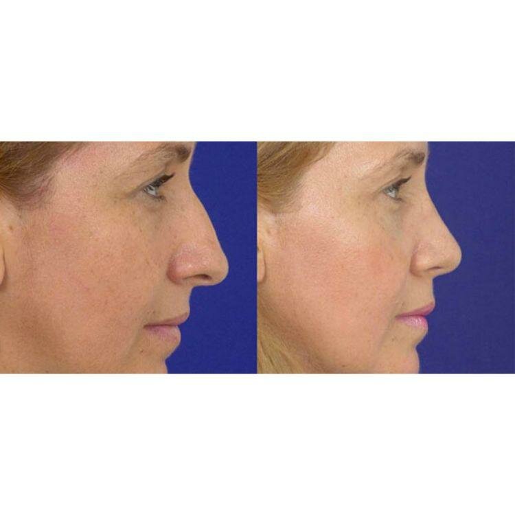 Plastik cerrahi klinikleri Dr Jorge Alirio Holguin Ruiz, Cali, foto