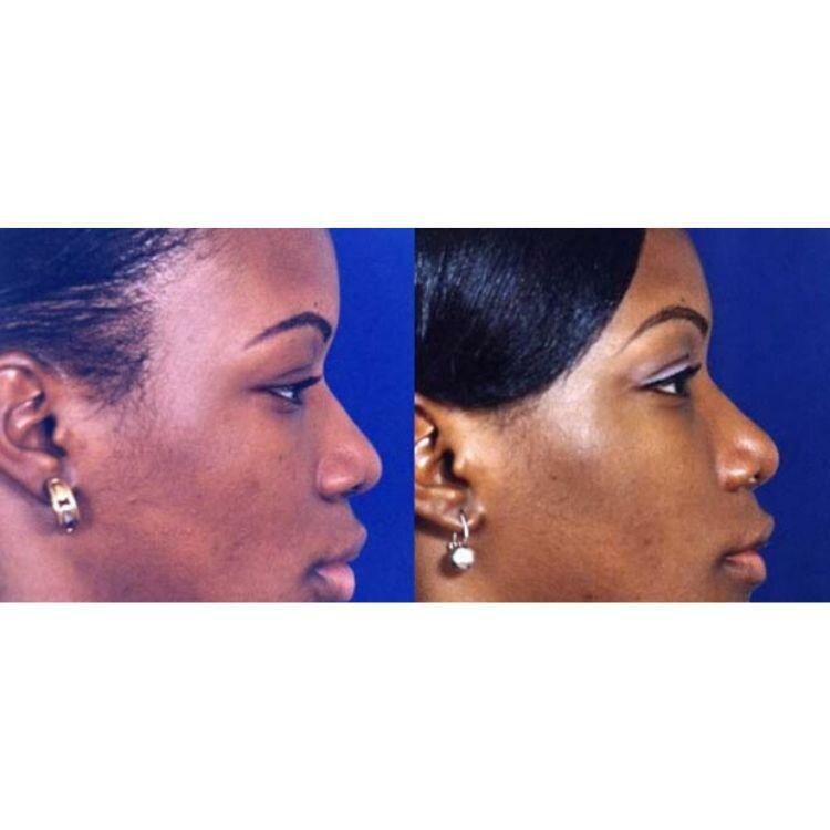 Plastik cerrahi klinikleri Dr Jorge Alirio Holguin Ruiz, Cali, foto