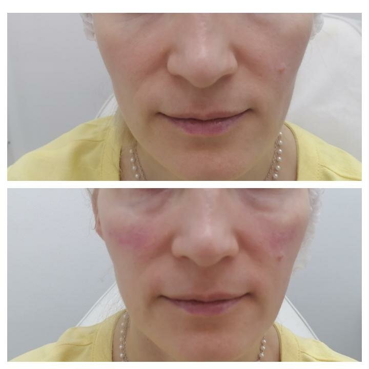 Kozmetoloji, kozmetik salonları ИП Мальцева В.М., Moskova, foto