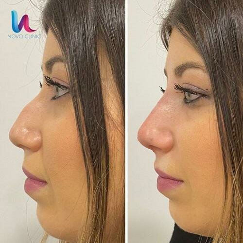 Güzellik salonu Novo Clinic Medicina Estética EN Madrid, Madrid, foto