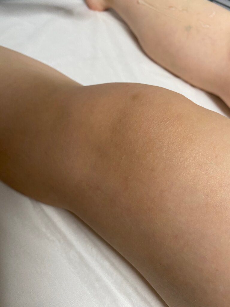 Epilasyon Glow laser, Nijni Novgorod, foto