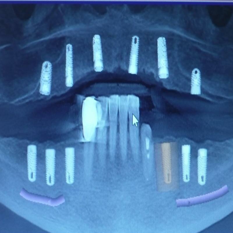 Özel ağız ve diş sağlığı klinikleri ve muayenehaneleri Studio Dentistico Dr. Sergio Avi, , foto