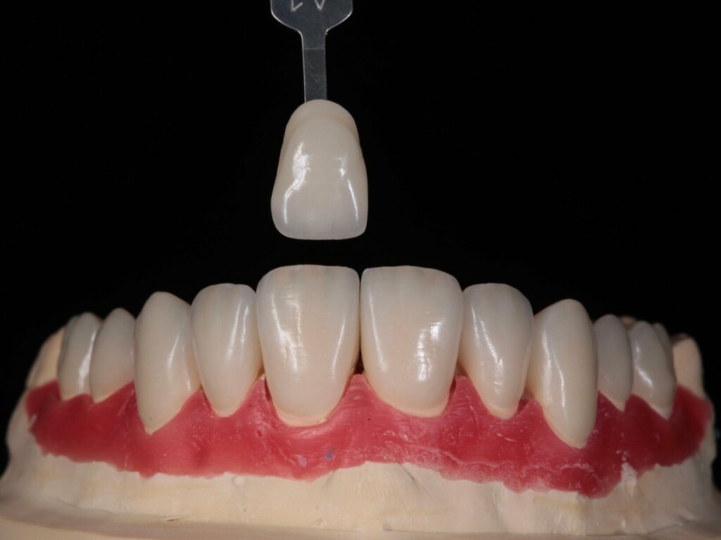 Diş laboratuvarı StartSmile, Stavropol, foto