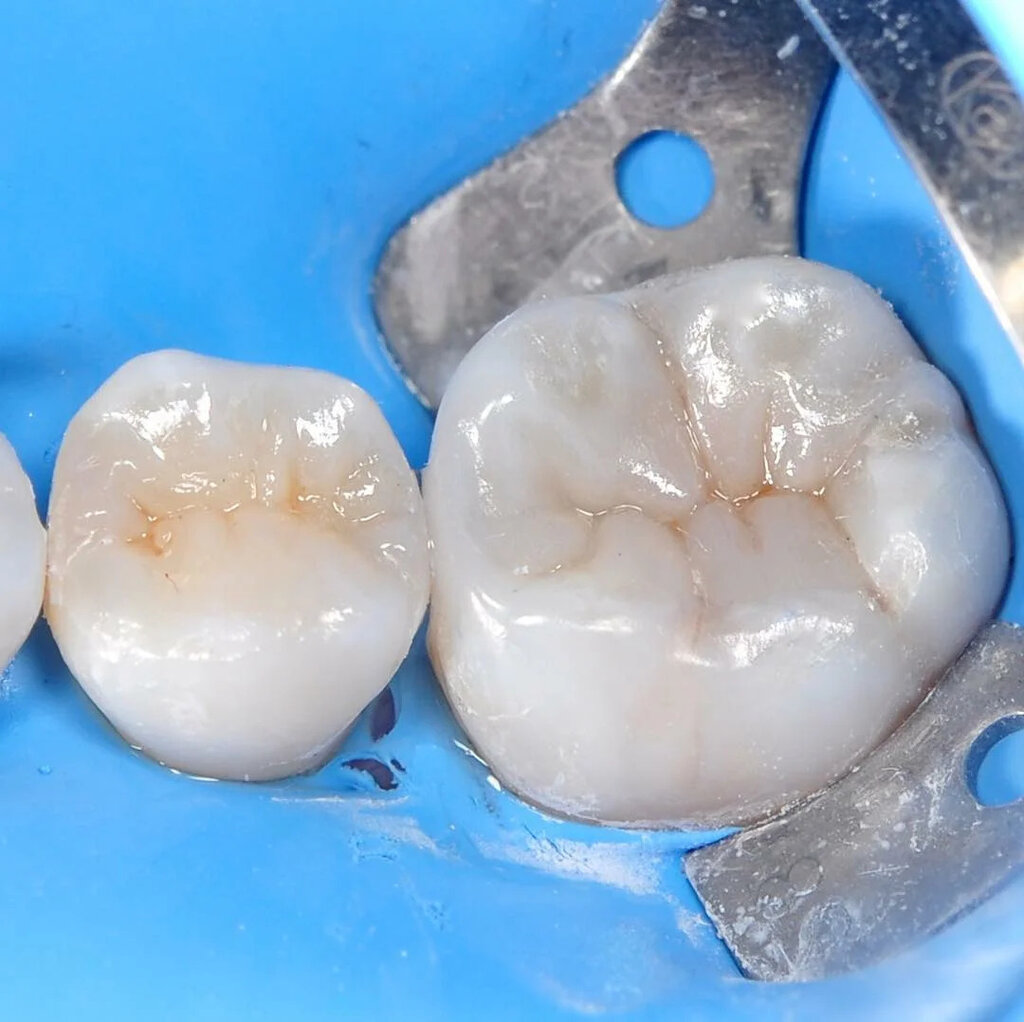 Özel ağız ve diş sağlığı klinikleri ve muayenehaneleri Dent island, Moskovski, foto