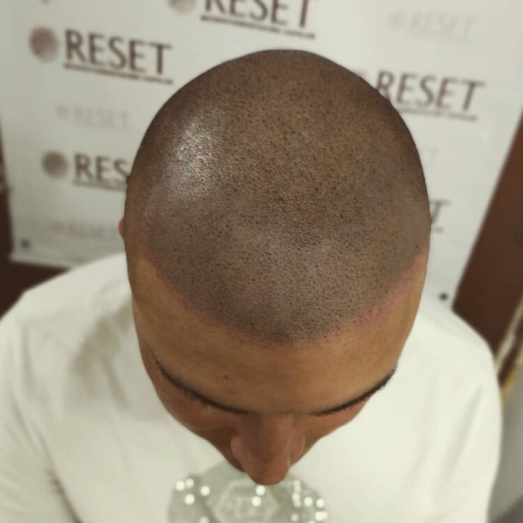 Güzellik salonu Resetmicropigmentacion, Cali, foto