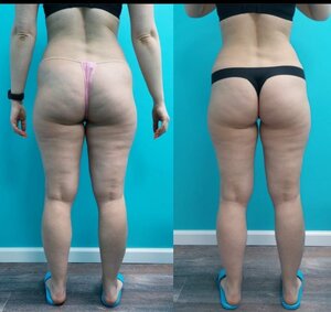 Body Life (Transportnaya ulitsa No:7, Orenburg), güzellik salonu  Orenburg'dan