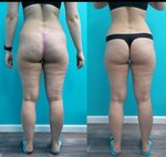 Body Life (Transportnaya ulitsa No:7), güzellik salonu  Orenburg'dan