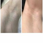 Lazer_Lyusi (ulitsa Mikhaila Marchenko No:3, rabochiy posyolok Sverdlovskiy), kozmetoloji, kozmetik salonları  Moskova ve Moskovskaya oblastından