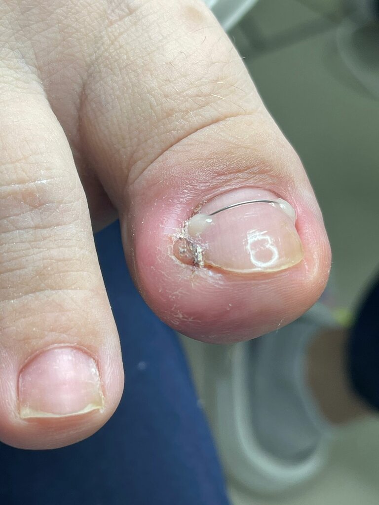 Podoloji Подолог, Briansk, foto