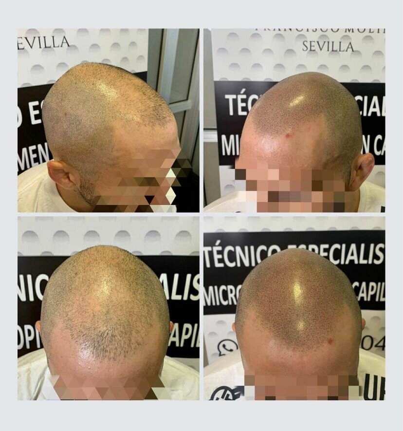 Sağlık merkezleri Micro capilar Francisco Molina, Sevilla, foto