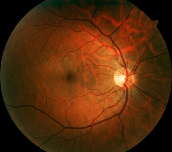 Optik Bright Eyes Optical, Ohio Eyaleti, foto