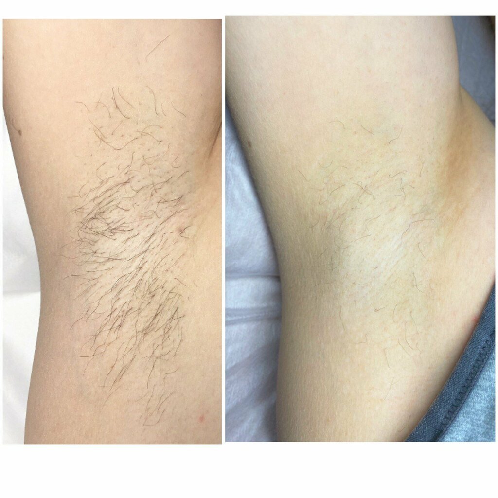 Epilasyon Alens_Studio, Moskova ve Moskovskaya oblastı, foto