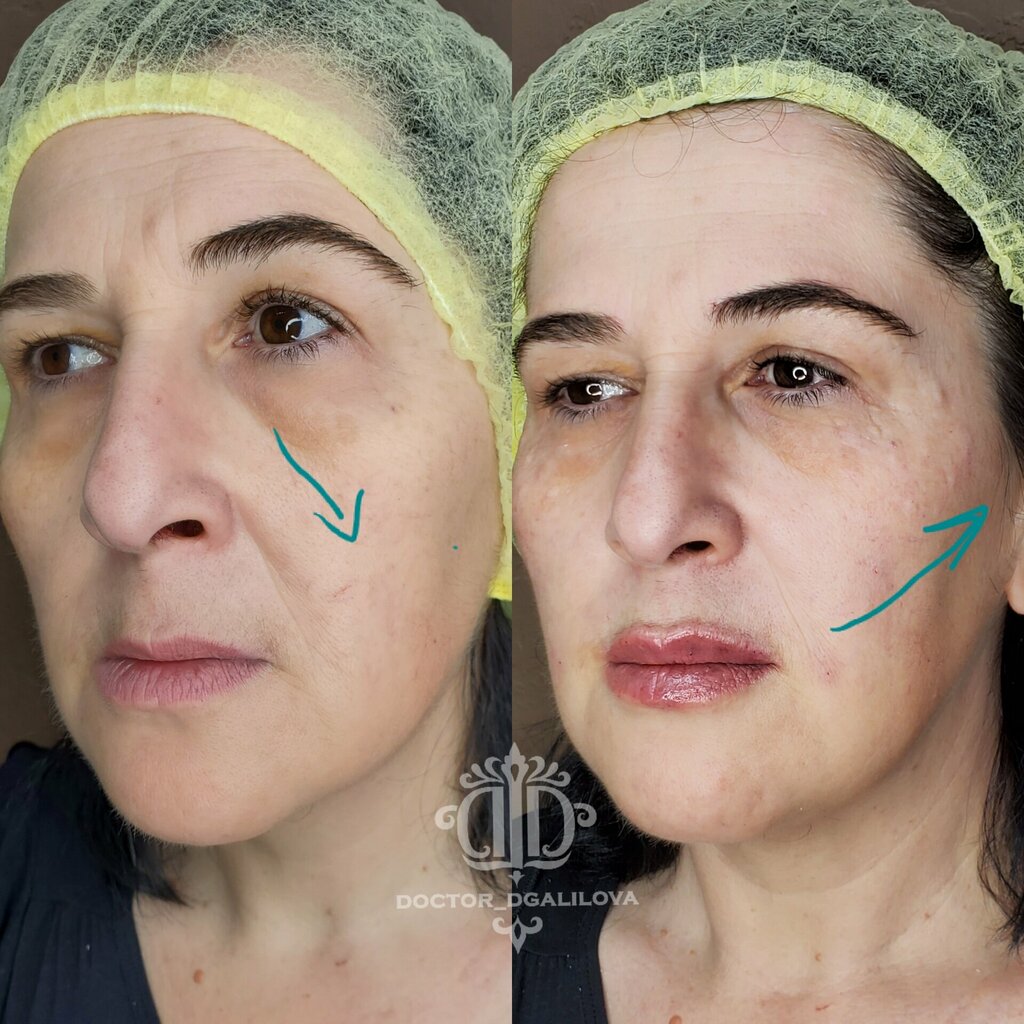 Kozmetoloji, kozmetik salonları Cosmetology of E. G. Jalilova, Moskova, foto