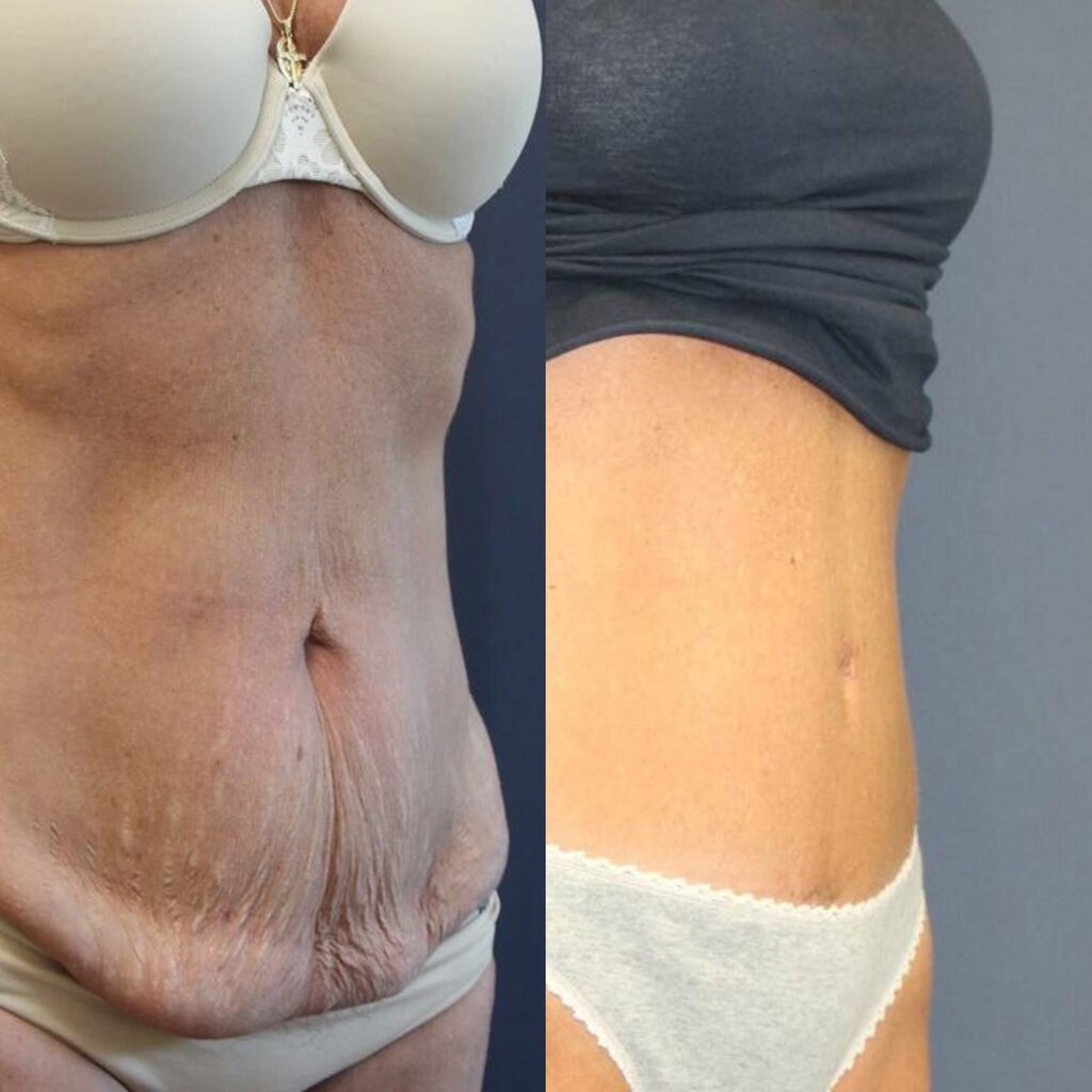 Plastik cerrahi klinikleri Пластический хирург Али Зиядинов, Moskova, foto