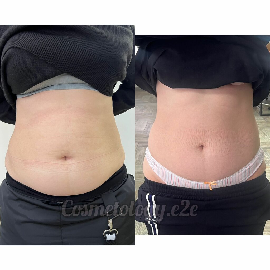 Kozmetoloji, kozmetik salonları ProBotoxx, Almatı, foto