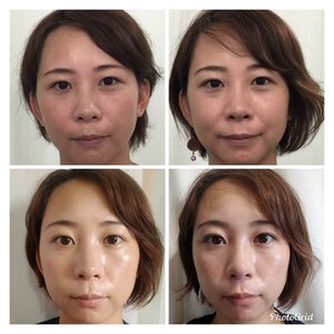 Full-fledged Lymphatic Manipulative Clinic RunWalk (Takarazuka, 1-2-2 Nogami, Wakabaso 203), tıp merkezleri ve klinikler