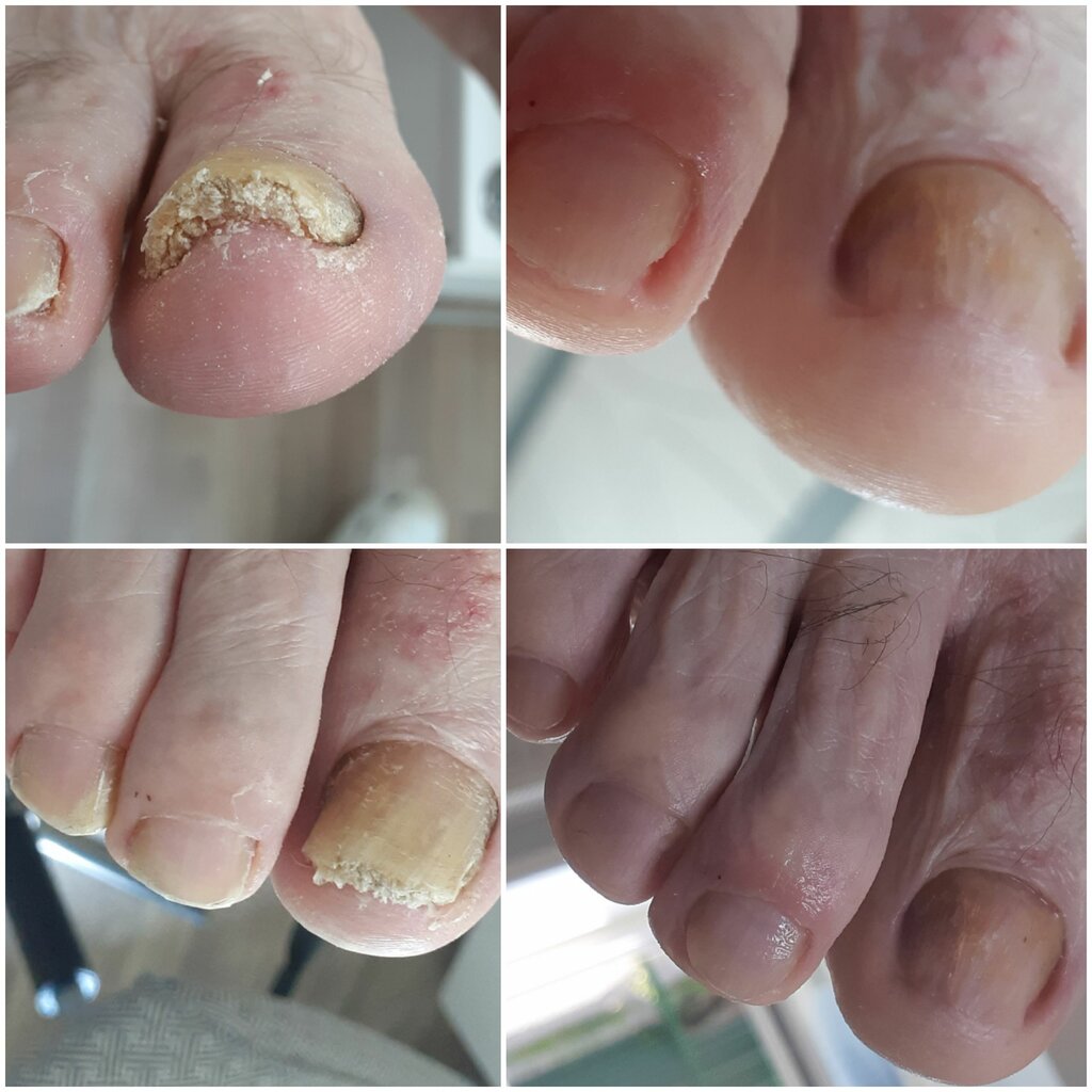 Podoloji Подолог, Yeysk, foto