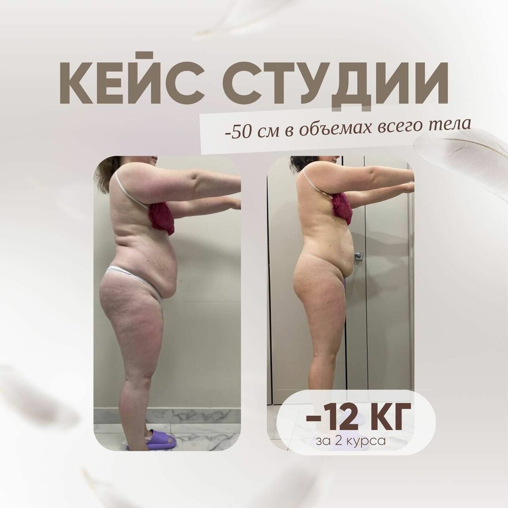 Masaj salonları Protelo, Yoshkar‑Ola, foto