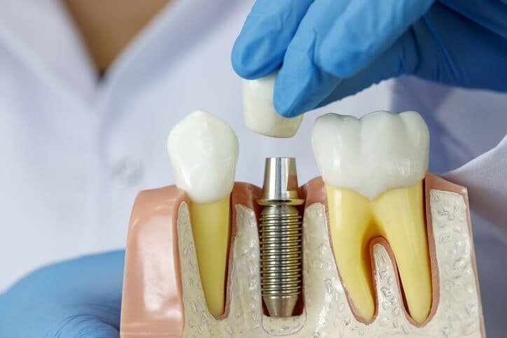 Özel ağız ve diş sağlığı klinikleri ve muayenehaneleri Hollywood Smile, Dubai, foto