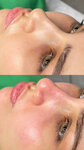 Dr. Azaliya Ilnarovna Cosmetology (ulitsa Michurina No:14, selo Vysokaya Gora), kozmetoloji, kozmetik salonları  Tataristan'dan