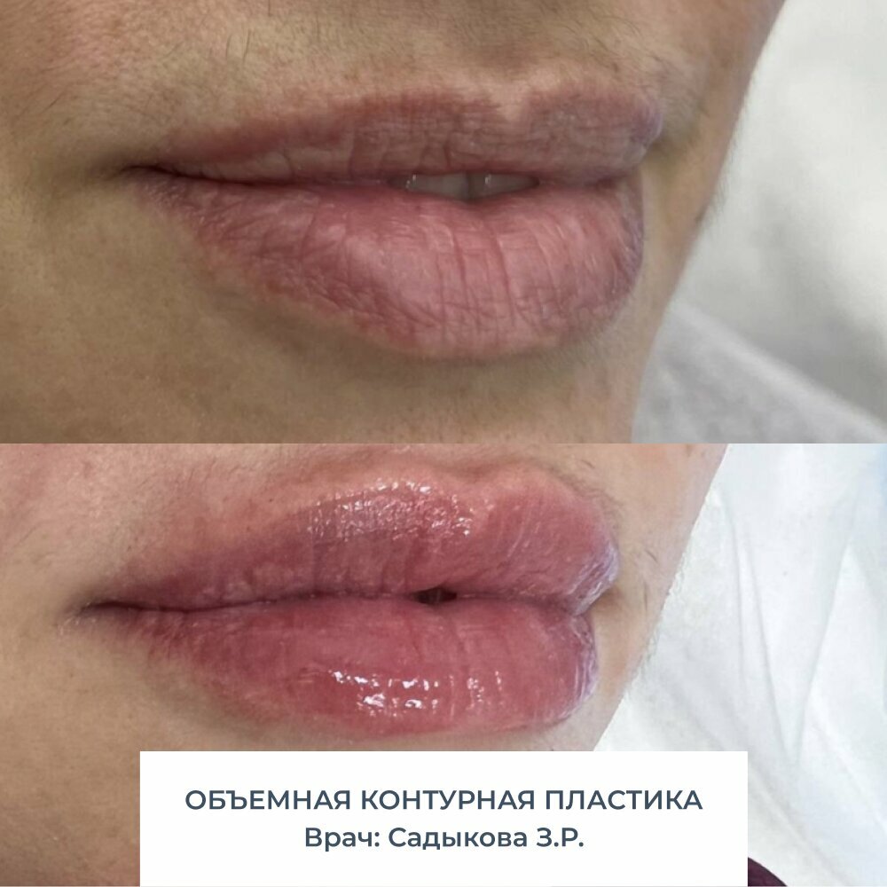 Kozmetoloji, kozmetik salonları A Plus Clinic, Moskova, foto