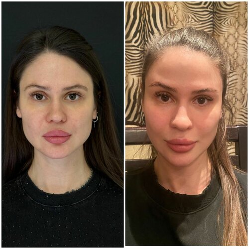 Estetica&Gargona, студия перманентного макияжа, Дальний пр., 11, корп ...