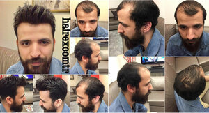 Hairex Hair Design (Samsun, İlkadım, İstiklal Cad., 32K), berberler  Samsun'dan