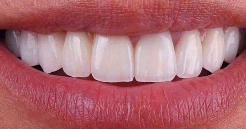 Özel ağız ve diş sağlığı klinikleri ve muayenehaneleri Bezrukoff Dental Office, Moskova, foto