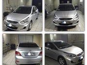 Hyundai Solaris I 1.6 AT 123 л.с.бензин, передний