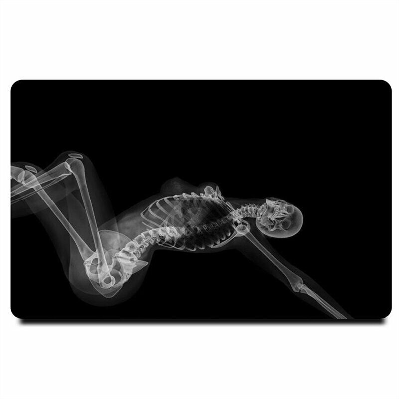 Магнит на холодильник "Эротическое фото через рентген"