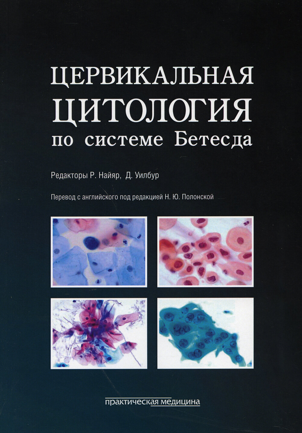 Уценка Цервикальная цитология по системе Бетесда. Терминология, критерии и пояснения. Под ред. Найяр Р.,Уилбура Д.