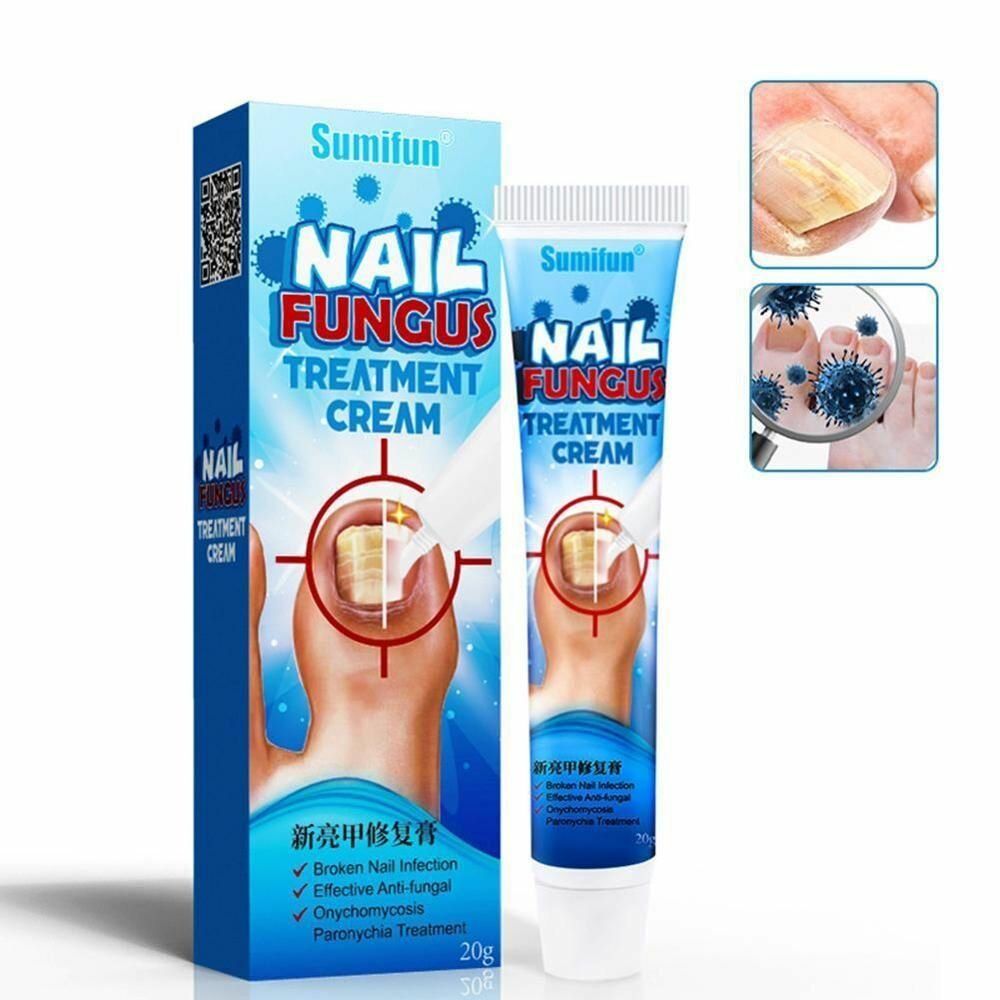 Травяной крем от грибка ногтей Sumifun Nail Fungus Treatment Cream, 20гр