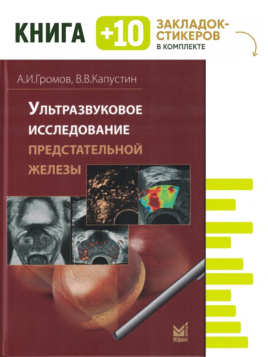 Ультразвуковое исследование предстательной железы. Комплект: книга + 10 закладок-стикеров