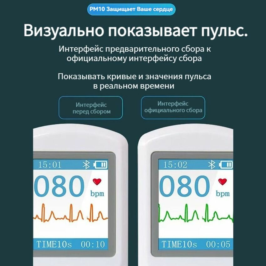 Contec Кардиомонитор PM10 — фото 1
