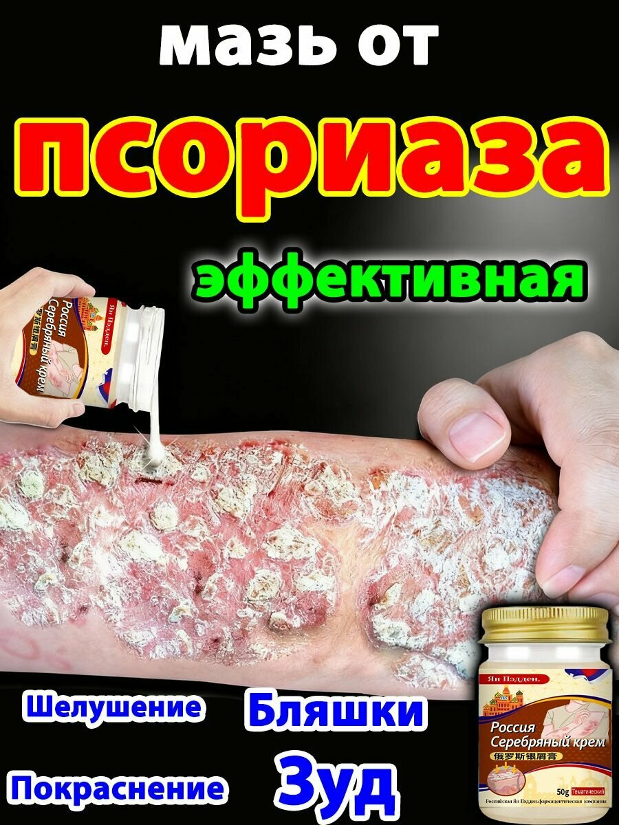 Мазь от псориаза, от зуда, от шелушения, от дерматита, от экземы, против покраснений, крем для лица и рук,50 мл