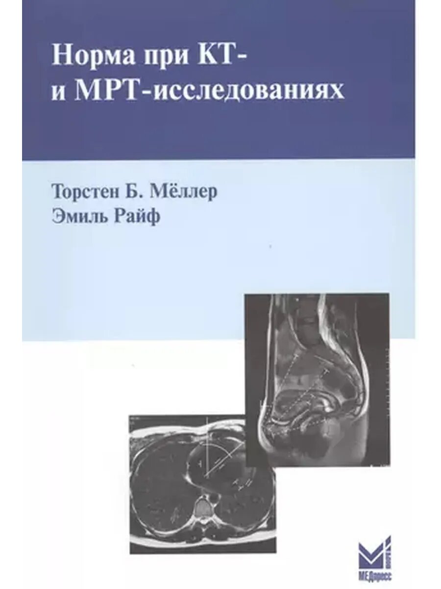 Норма при КТ - и МРТ - исследованиях