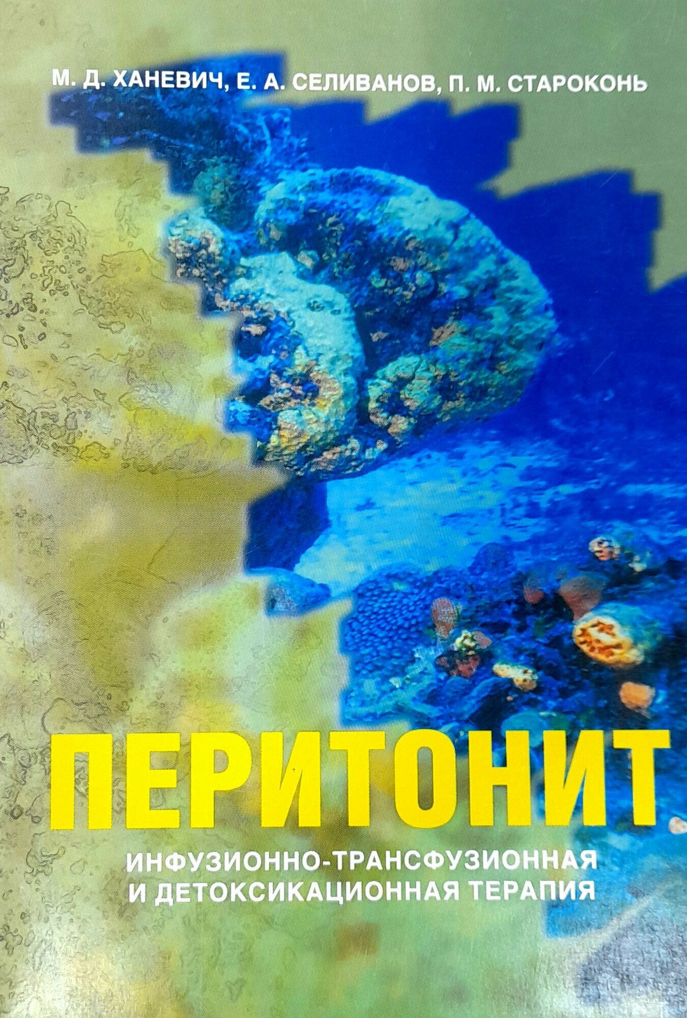 Перитонит: инфузионно-трансфузионная и детоксикационная терапия. М. Ханевич