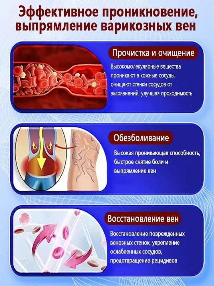 Китайский травяной крем натуральный мазь от варикоза вен. Гель от усталости и тяжести в ногах