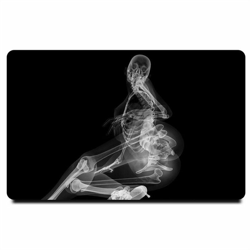 Магнит на холодильник "Эротическое фото через рентген"