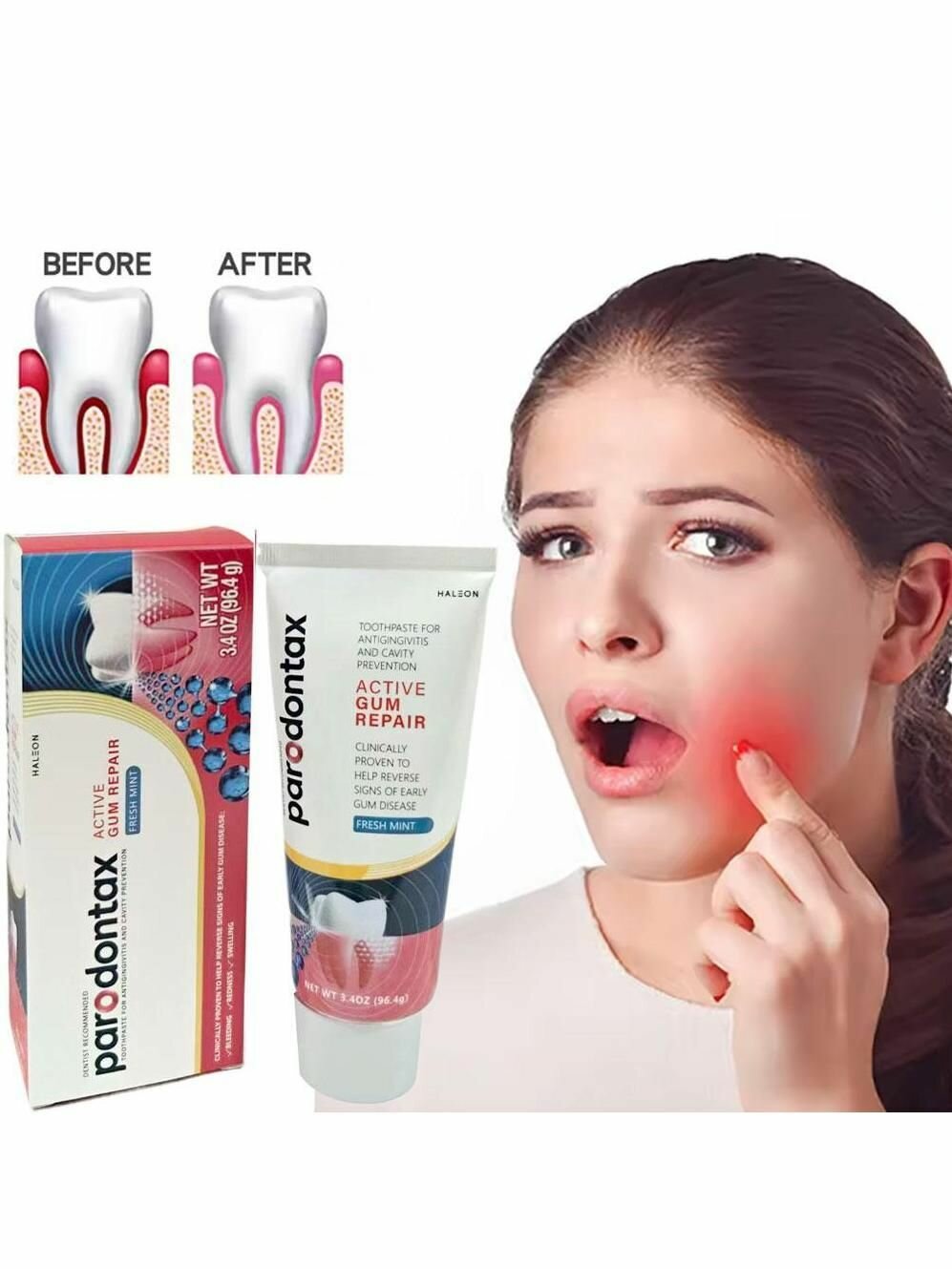 Зубная паста, которая может вылечить пародонтит, Устраняет кровоточивость десен, отек и т. д.