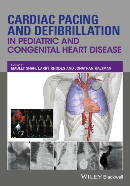 Shah "Cardiac Pacing and Defibrillation in Pediatric and Congenital Heart Disease"