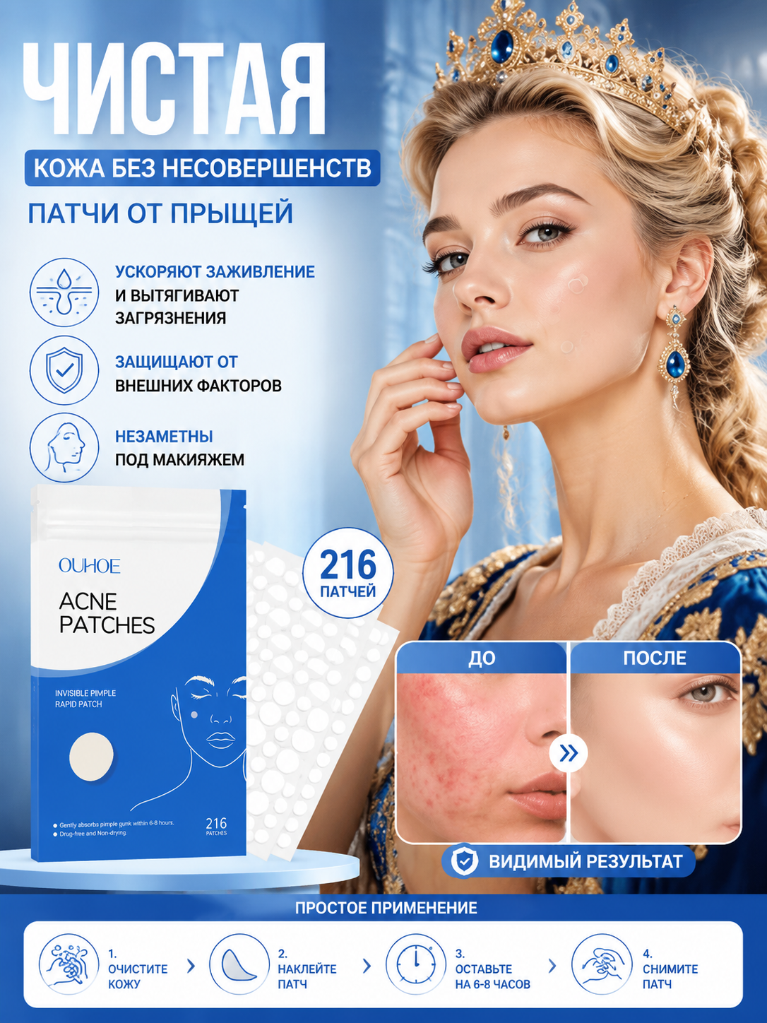 Мягкие косметические пластыри от прыщей для лица, маскировка и уход за кожей, компактный формат для ношения с собой