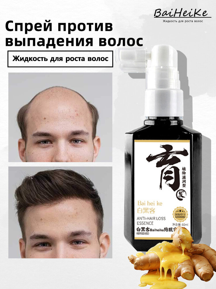 Жидкость для роста волос 60 мл предотвращает выпадение волос и способствует их росту
